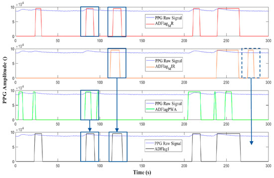 A New Wearable System for Home Sleep Apnea Testing, Screening, and ...