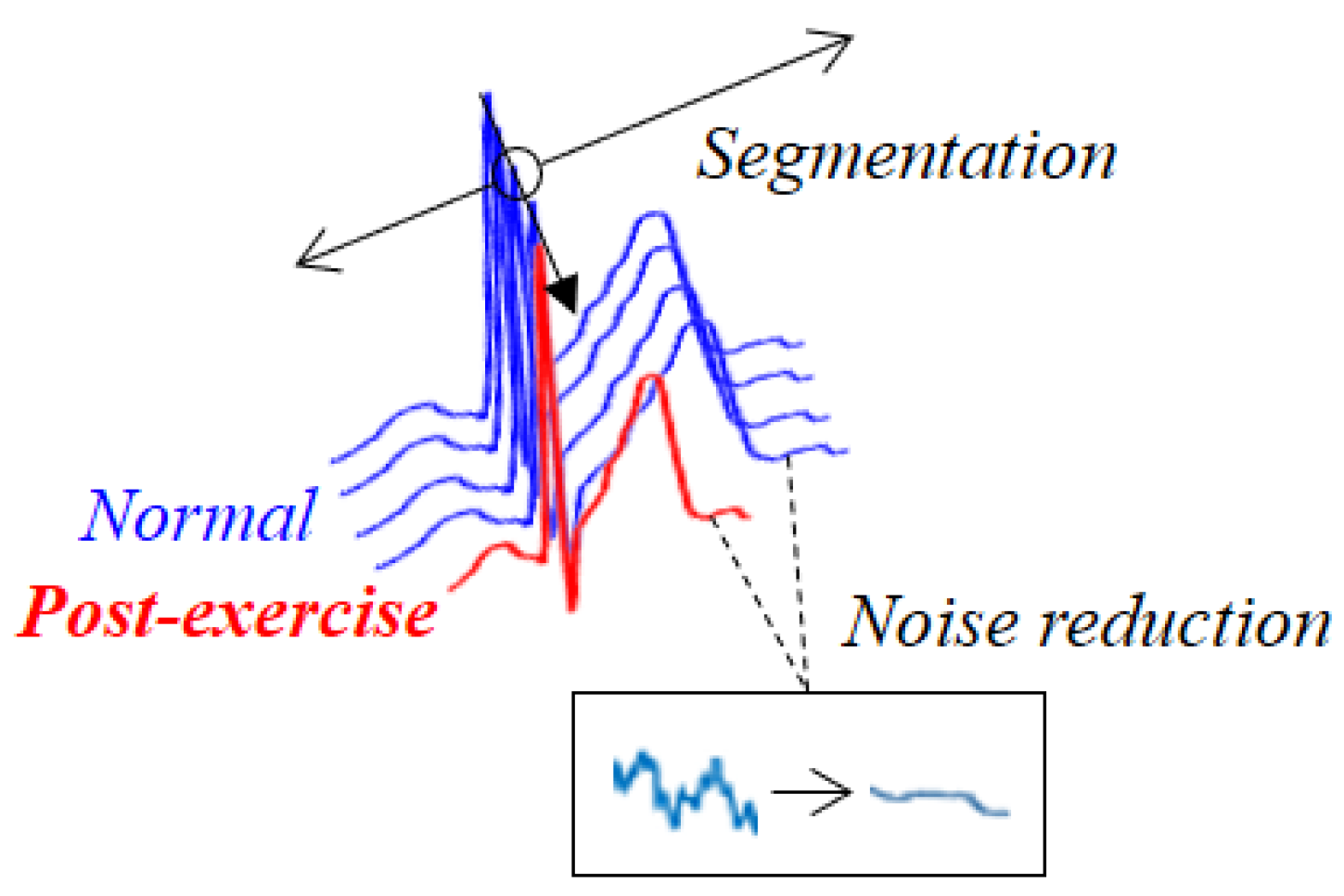 Recognition System Using Fusion Normalization Based on Morphological Features of Post-Exercise ...