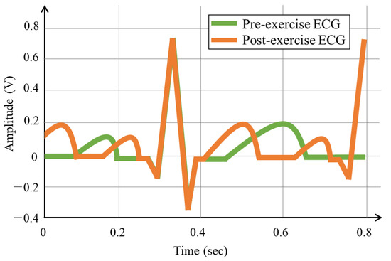 Sensors | Free Full-Text | Recognition System Using Fusion Normalization Based on Morphological ...