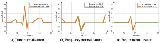 Sensors | Free Full-Text | Recognition System Using Fusion Normalization Based on Morphological ...