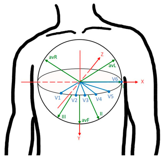 Sensors | Free Full-Text | Automatic Classification of Myocardial ...