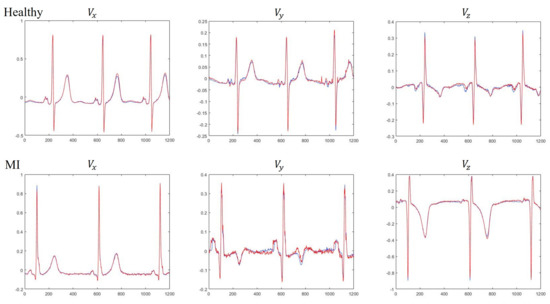 Sensors | Special Issue : Advanced Signal Processing in Wearable ...