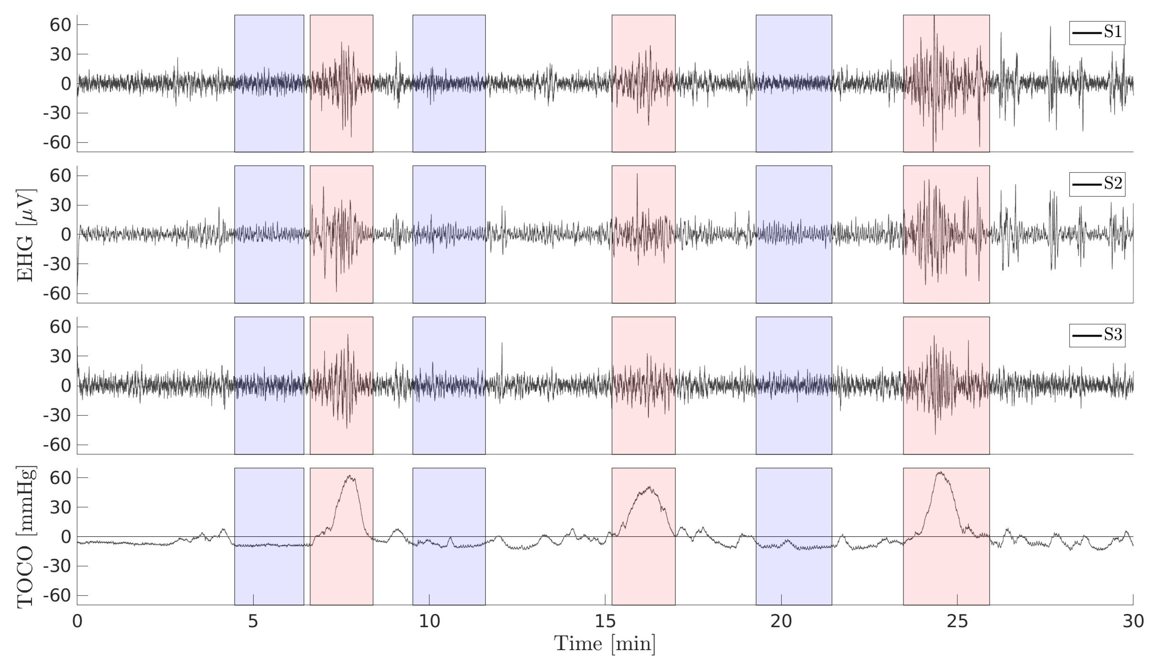 Sensors | Free Full-Text | Assessing Velocity and Directionality of ...