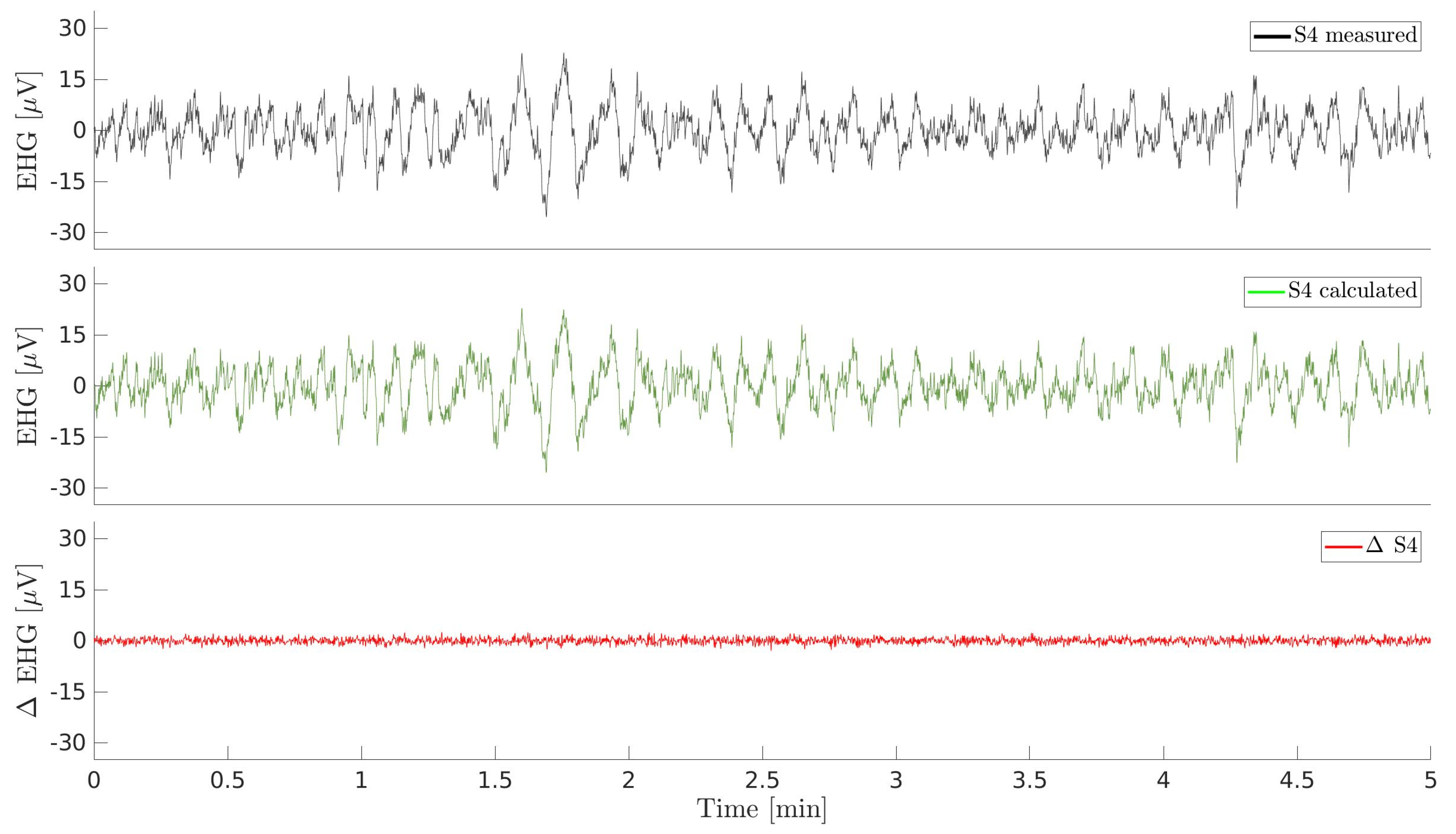 Sensors | Free Full-Text | Assessing Velocity and Directionality of ...