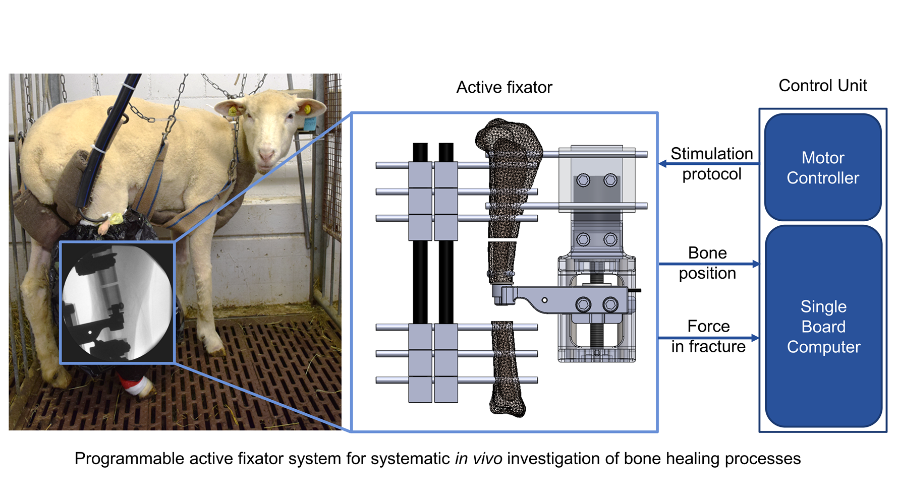 Sensors | Free Full-Text | Programable Active Fixator System for ...