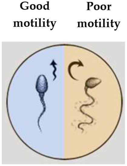 Deep Learning Based Evaluation of Spermatozoid Motility for Artificial ...