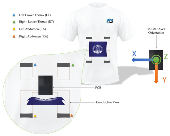 Sensors | Topical Collection : Respiratory Monitoring for Healthcare ...