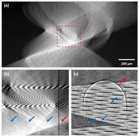 Complete Ring Artifacts Reduction Procedure for Lab-Based X-ray Nano CT ...