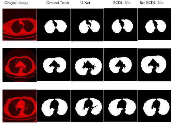 ResBCDU-Net: A Deep Learning Framework for Lung CT Image Segmentation