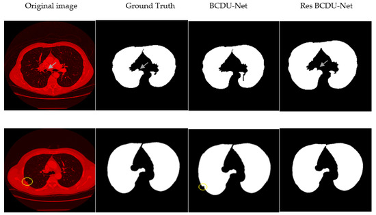 ResBCDU-Net: A Deep Learning Framework for Lung CT Image Segmentation