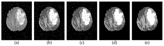Intuitionistic Fuzzy C-Means Algorithm Based on Membership Information ...