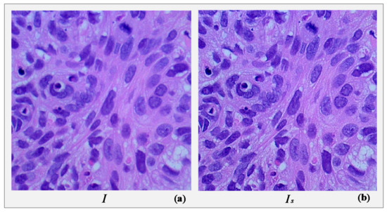 A Machine Learning Approach to Diagnosing Lung and Colon Cancer Using a ...