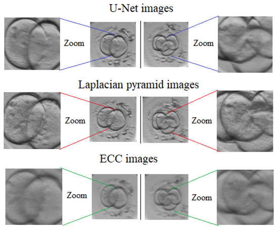 Fast Multi-Focus Fusion Based on Deep Learning for Early-Stage Embryo ...