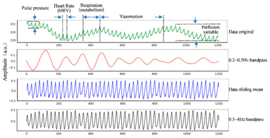An iPPG-Based Device for Pervasive Monitoring of Multi-Dimensional ...