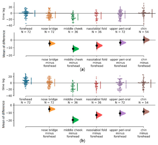 An iPPG-Based Device for Pervasive Monitoring of Multi-Dimensional ...