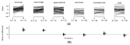 An iPPG-Based Device for Pervasive Monitoring of Multi-Dimensional ...