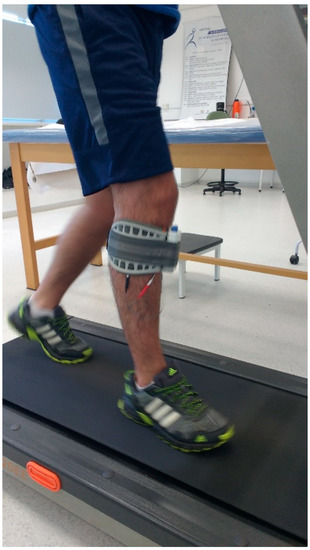 Functional Electrical Stimulation for Foot Drop in Post-Stroke People ...