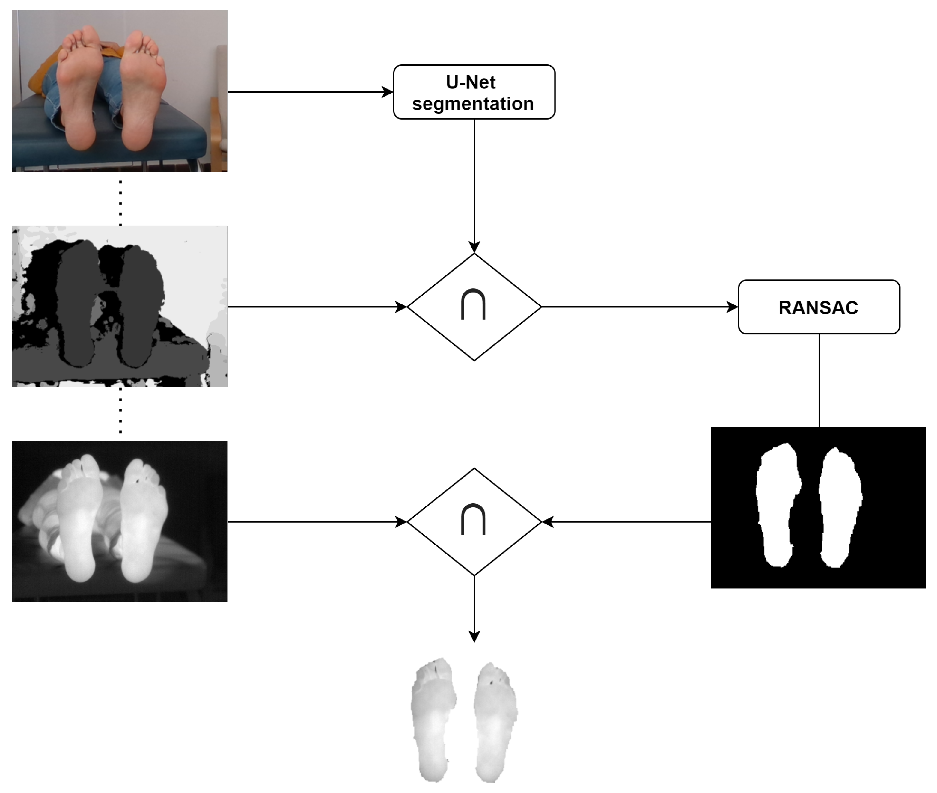 Segmentation Approaches for Diabetic Foot Disorders
