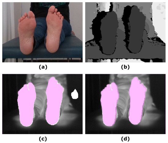 Segmentation Approaches for Diabetic Foot Disorders