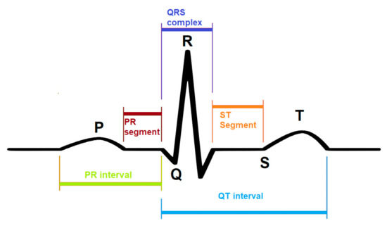 A Hybrid Deep CNN Model for Abnormal Arrhythmia Detection Based on Cardiac ECG Signal