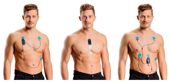 Wearable Devices Suitable for Monitoring Twenty Four Hour Heart Rate ...