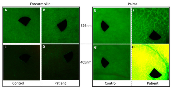 Visualization of Keratin with Diffuse Reflectance and Autofluorescence ...