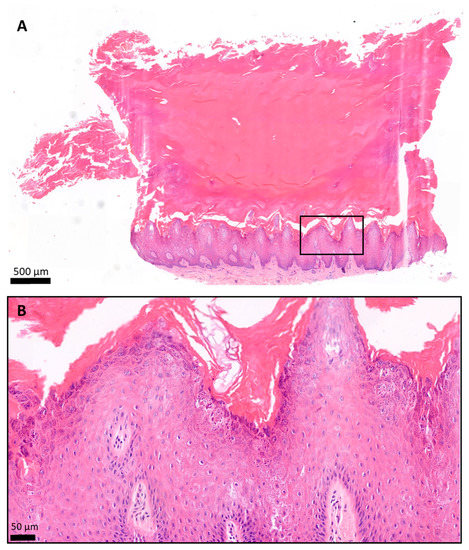 Visualization of Keratin with Diffuse Reflectance and Autofluorescence ...