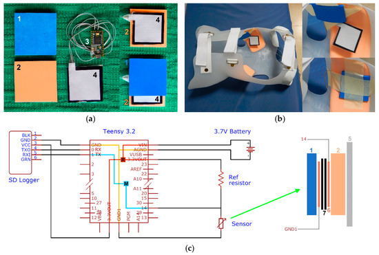 Pressure Sensor System for Customized Scoliosis Braces