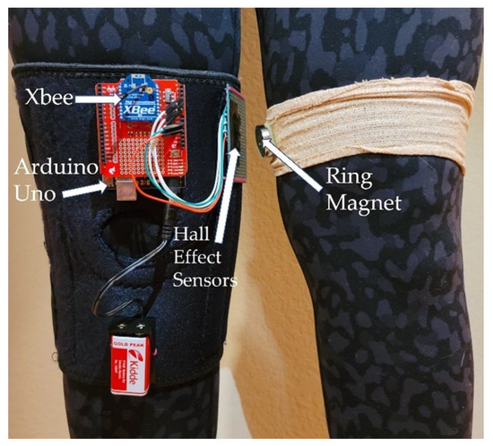 Sensors | Free Full-Text | Abnormal Gait Detection Using Wearable Hall ...