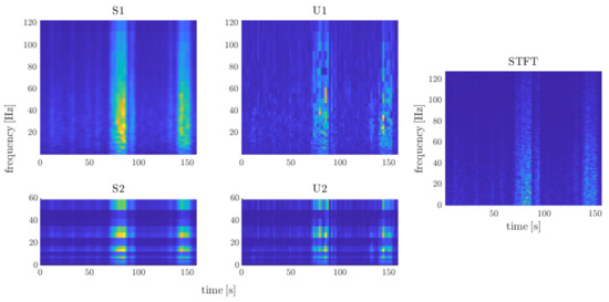 Multimodal Signal Analysis for Pain Recognition in Physiotherapy Using ...