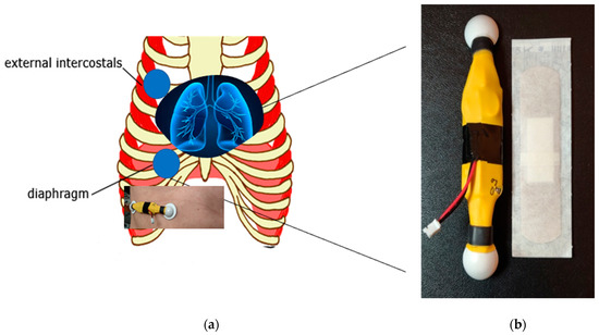 Extraction and Analysis of Respiratory Motion Using a Comprehensive ...