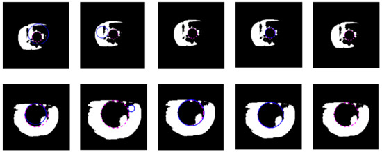 Robust Iris Segmentation Algorithm In Non Cooperative Environments Using Interleaved Residual U Net