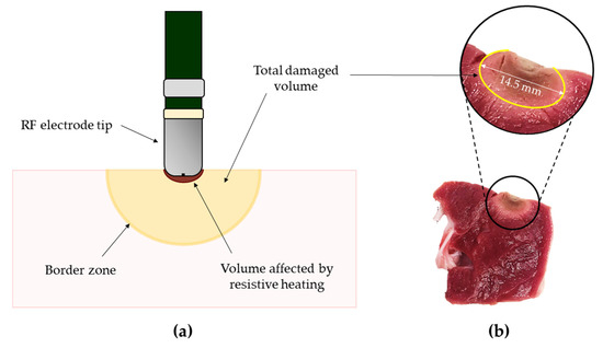 Techniques for Temperature Monitoring of Myocardial Tissue Undergoing ...
