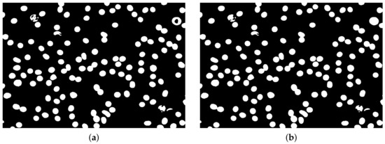 Sensors | Free Full-Text | Segmentation of Microscope Erythrocyte ...