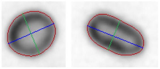 Sensors | Free Full-Text | Segmentation of Microscope Erythrocyte ...