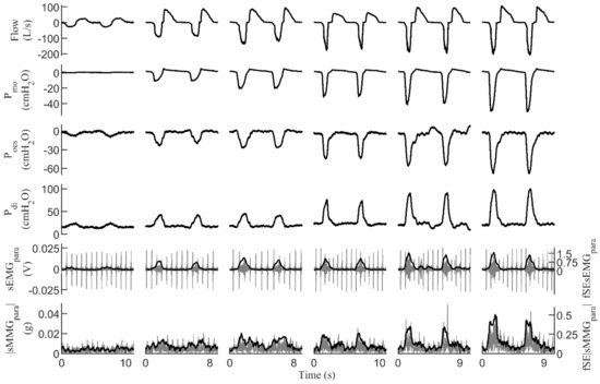 Noninvasive Assessment of Neuromechanical Coupling and Mechanical ...