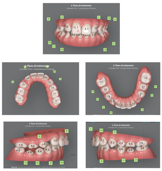 A Knowledge-Based Algorithm for Automatic Monitoring of Orthodontic ...