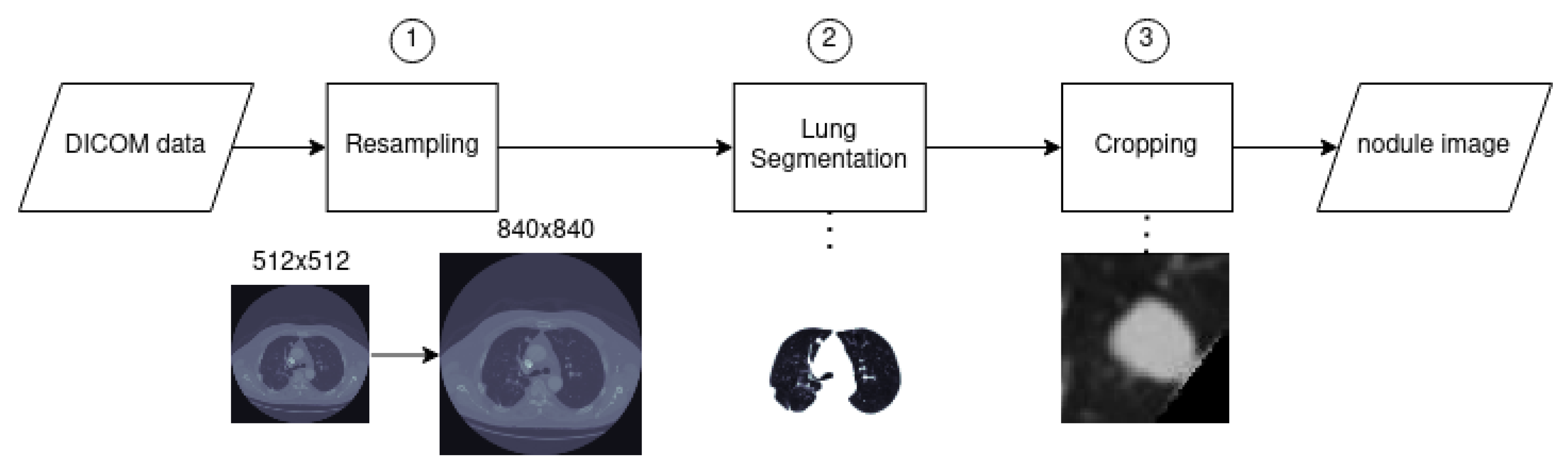 Lung Nodule Segmentation with a Region-Based Fast Marching Method