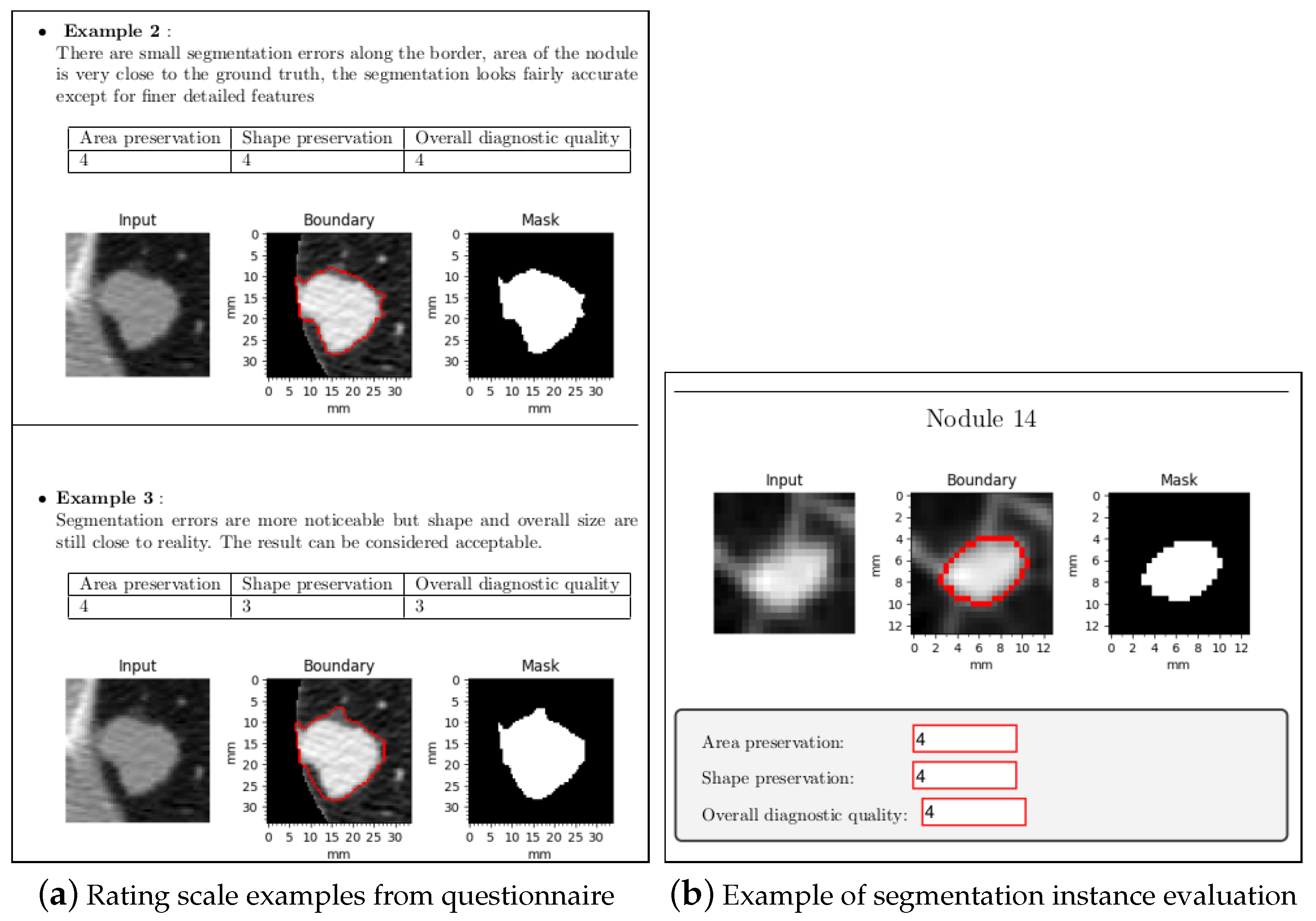 Lung Nodule Segmentation with a Region-Based Fast Marching Method