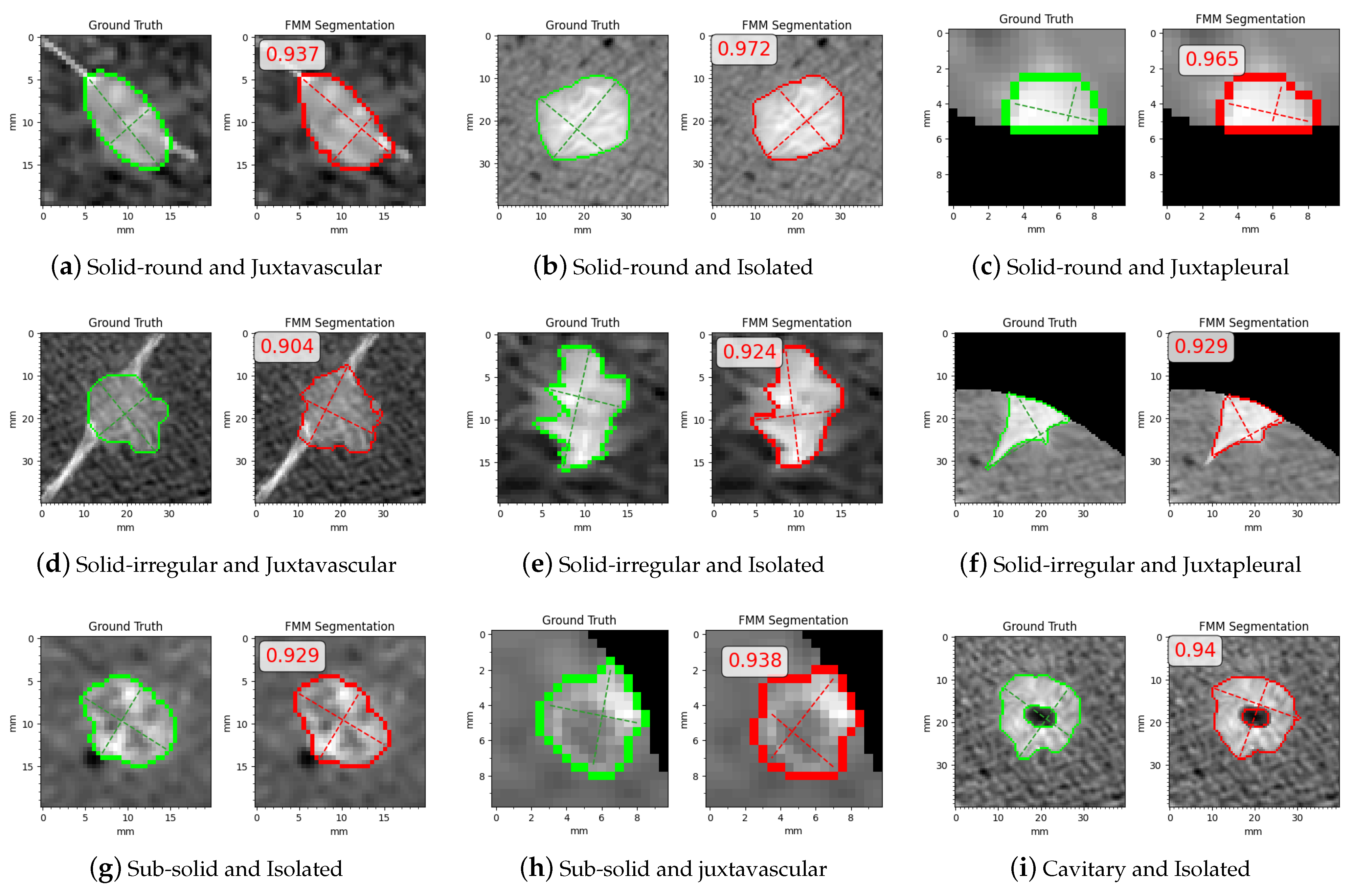 Lung Nodule Segmentation with a Region-Based Fast Marching Method
