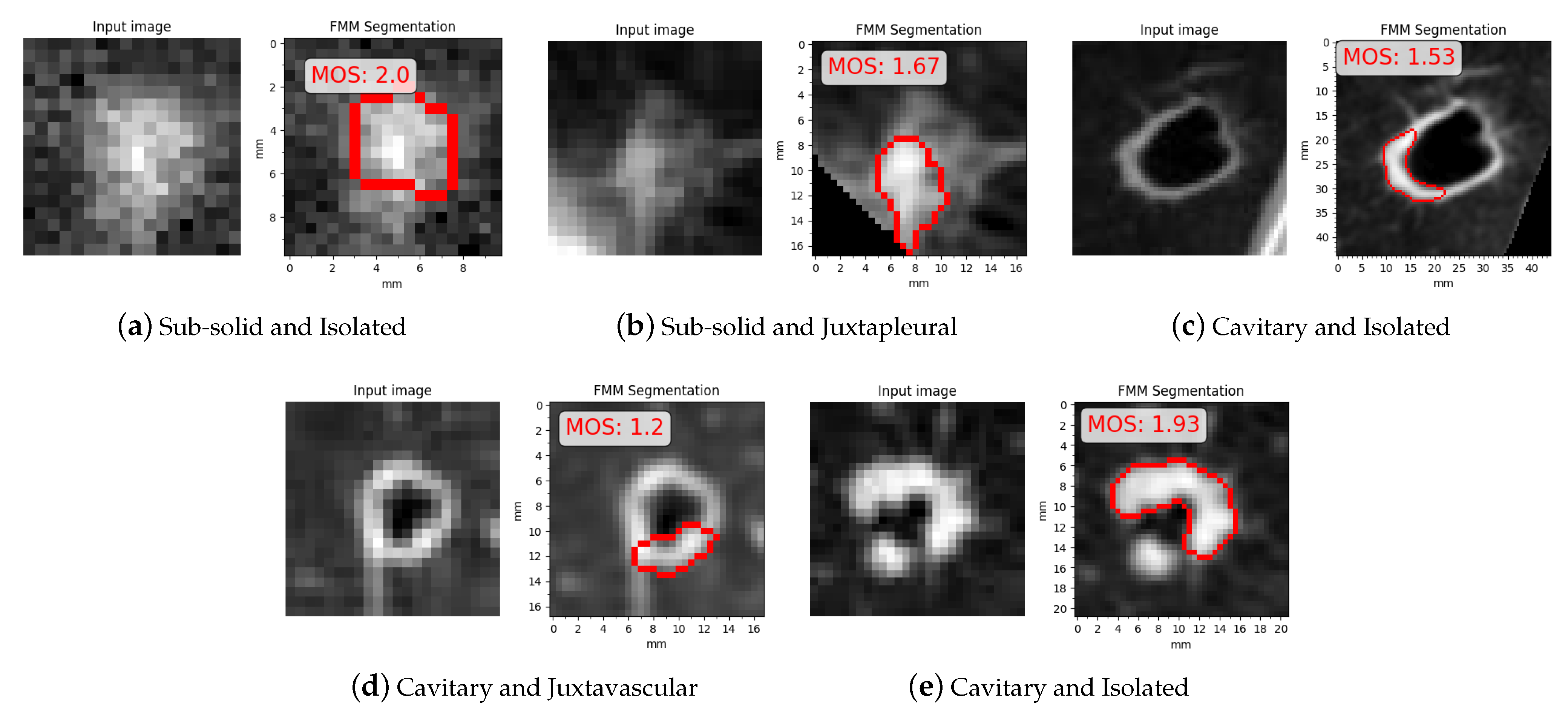 Lung Nodule Segmentation with a Region-Based Fast Marching Method
