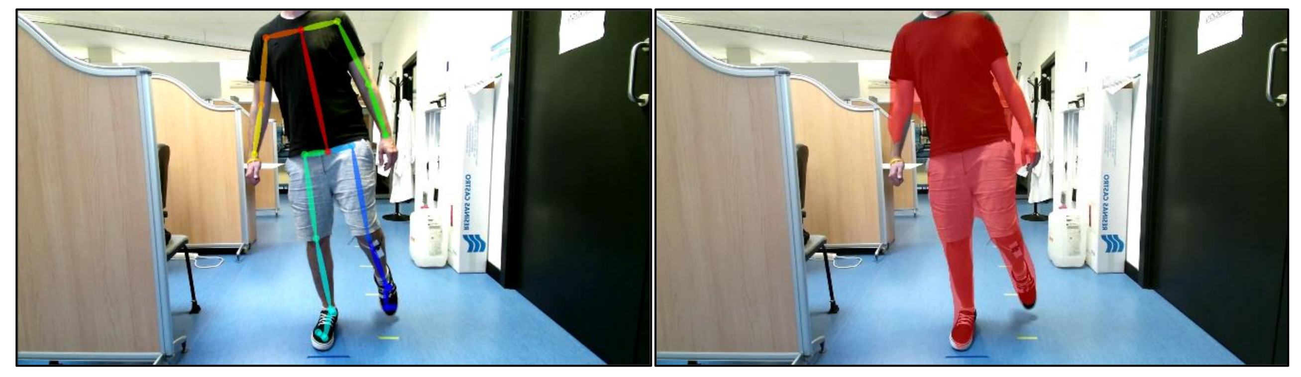 Automatic Ankle Angle Detection by Integrated RGB and Depth Camera System