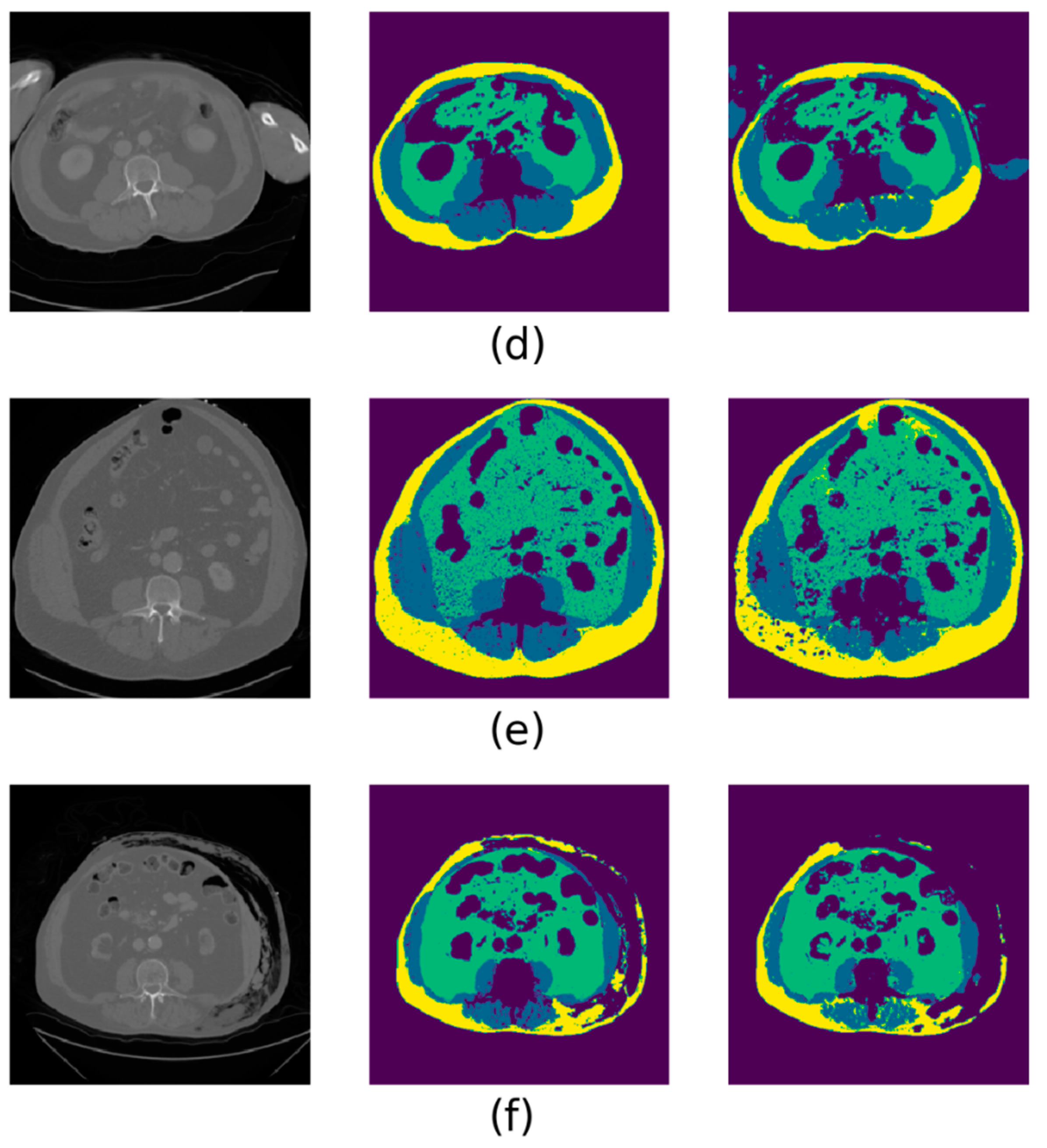 Sensors | Free Full-Text | Deep Learning Automated Segmentation for Muscle and Adipose Tissue ...