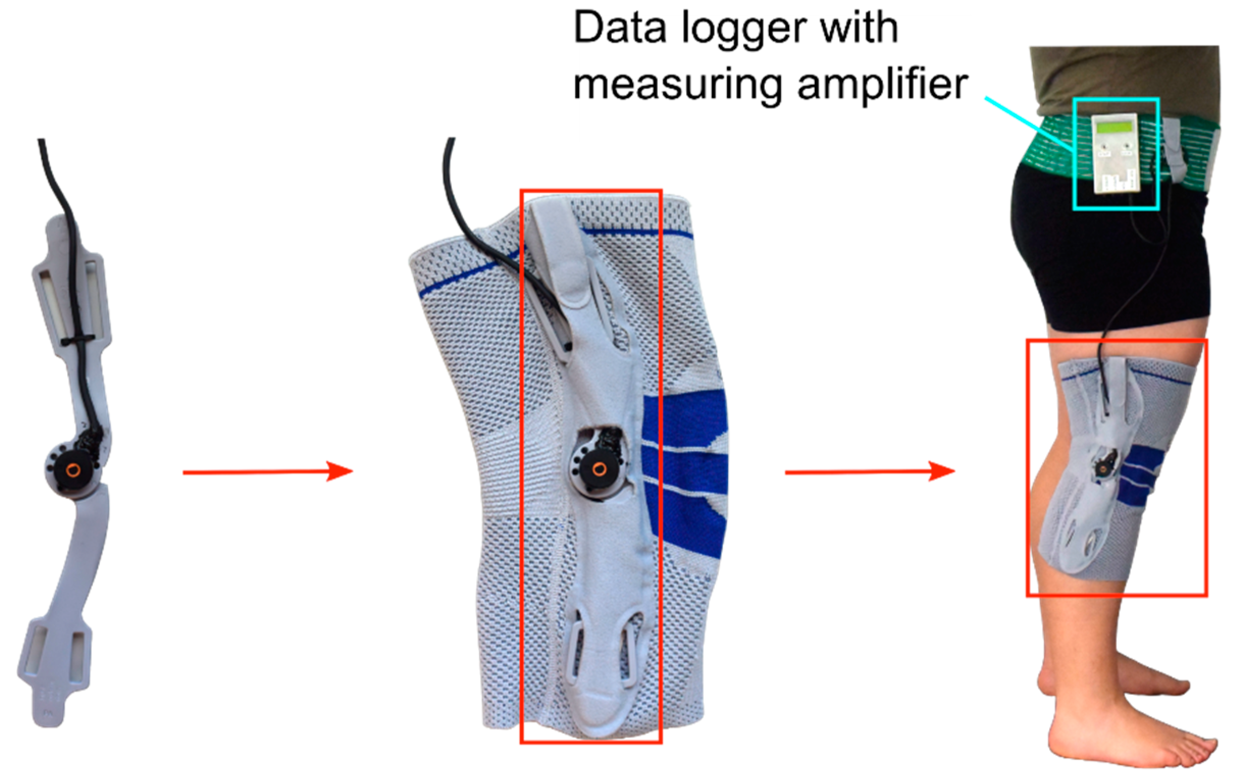 Integrating a Potentiometer into a Knee Brace Shows High Potential for ...