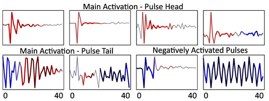Sensors | Free Full-Text | Interpretable Detection of Partial Discharge in Power Lines with Deep ...