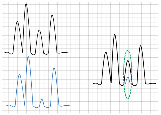 Accurate Spectral Estimation Technique Based on Decimated Linear ...
