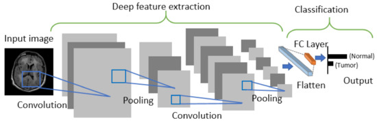 MRI-Based Brain Tumor Classification Using Ensemble of Deep Features ...
