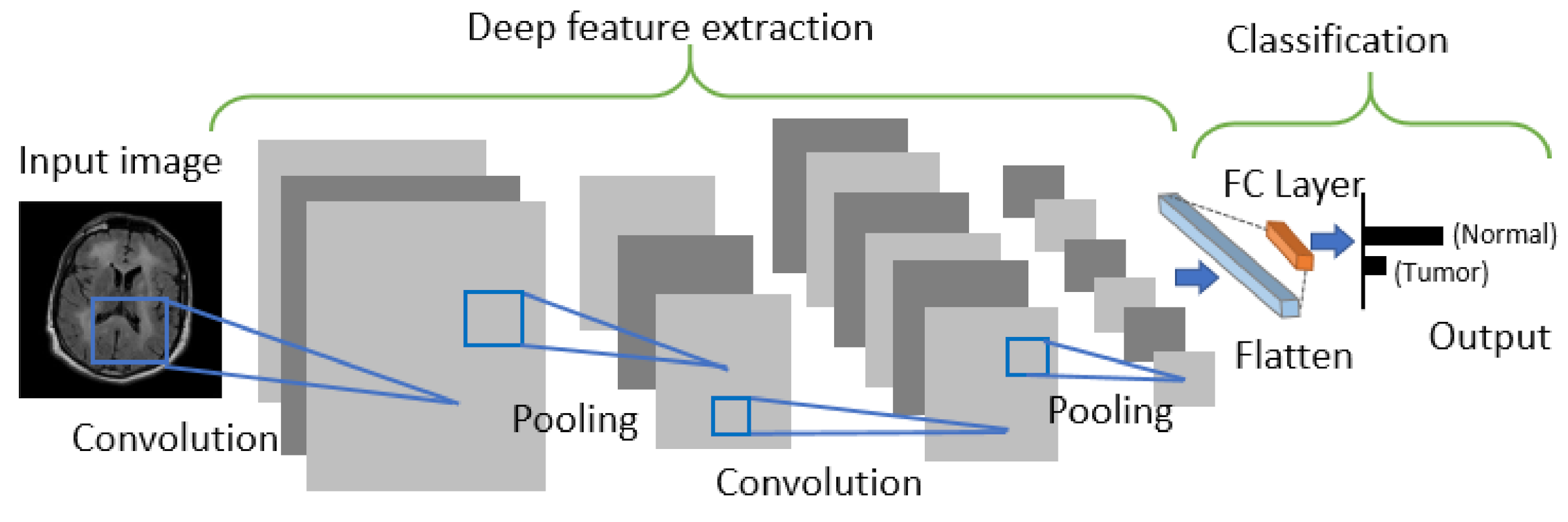 Sensors Free Full Text Mri Based Brain Tumor Classification Using Ensemble Of Deep Features