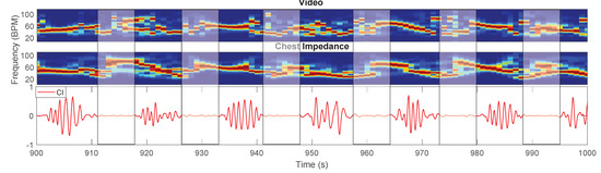 Towards Continuous Camera-Based Respiration Monitoring in Infants