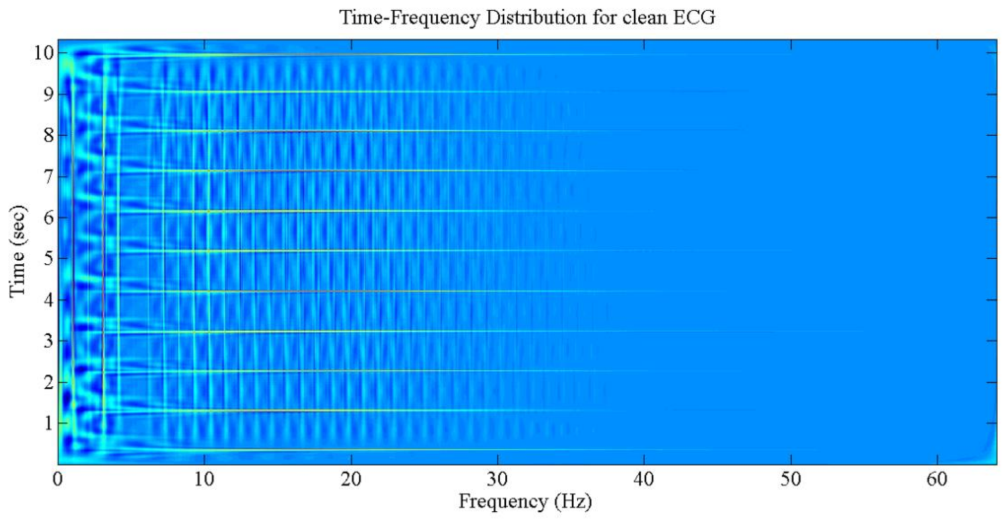 An Automated High-Accuracy Detection Scheme for Myocardial Ischemia Based on Multi-Lead Long ...